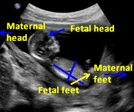 Information - OB Images - OB Images