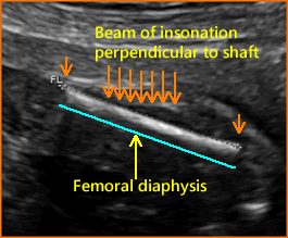 Fetal Ultrasound Education | OB Images | Call Now!